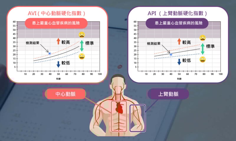 PASESA AVE-2000 PLUS 便攜式心血管硬化檢測儀 - 升級版 (BP03) - HKdigishop
