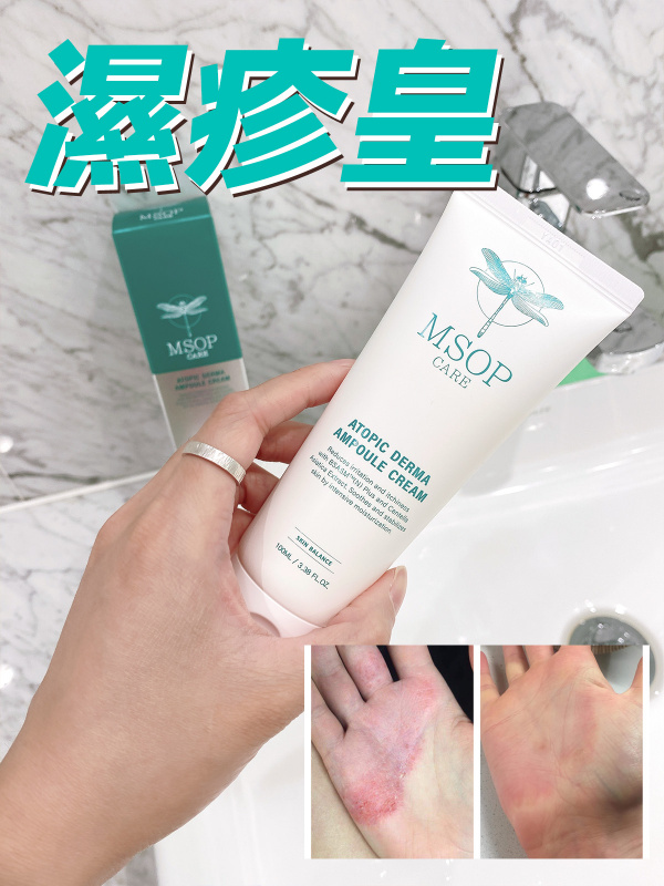 救命系列韓國製MSOP Care 濕疹皇 100ml ATOPIC DERMA AMPOULE CREAM - YELLOWHEBE SHOP