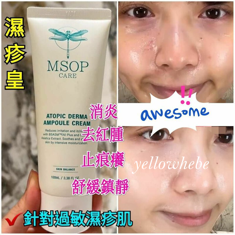 救命系列韓國製MSOP Care 濕疹皇 100ml ATOPIC DERMA AMPOULE CREAM - YELLOWHEBE SHOP