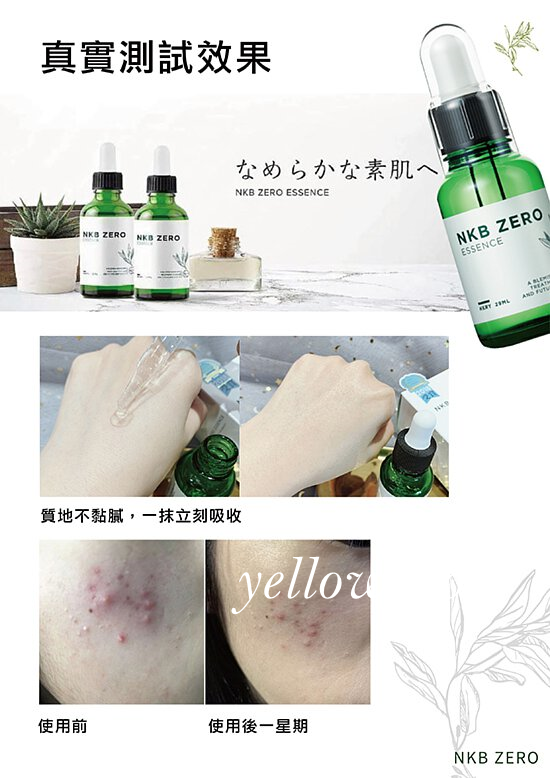 日本HERY NKB Zero 淡印抗敏抗痘修護美容精華 29ml - YELLOWHEBE SHOP