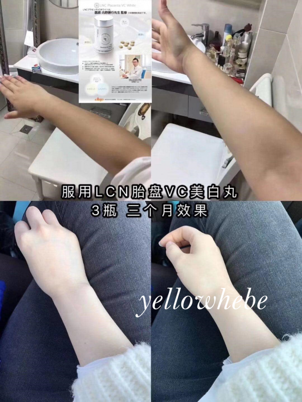 日本正貨LNC 胎盤素精華美白丸 Placenta VC White +Crysline 120粒裝 - YELLOWHEBE SHOP