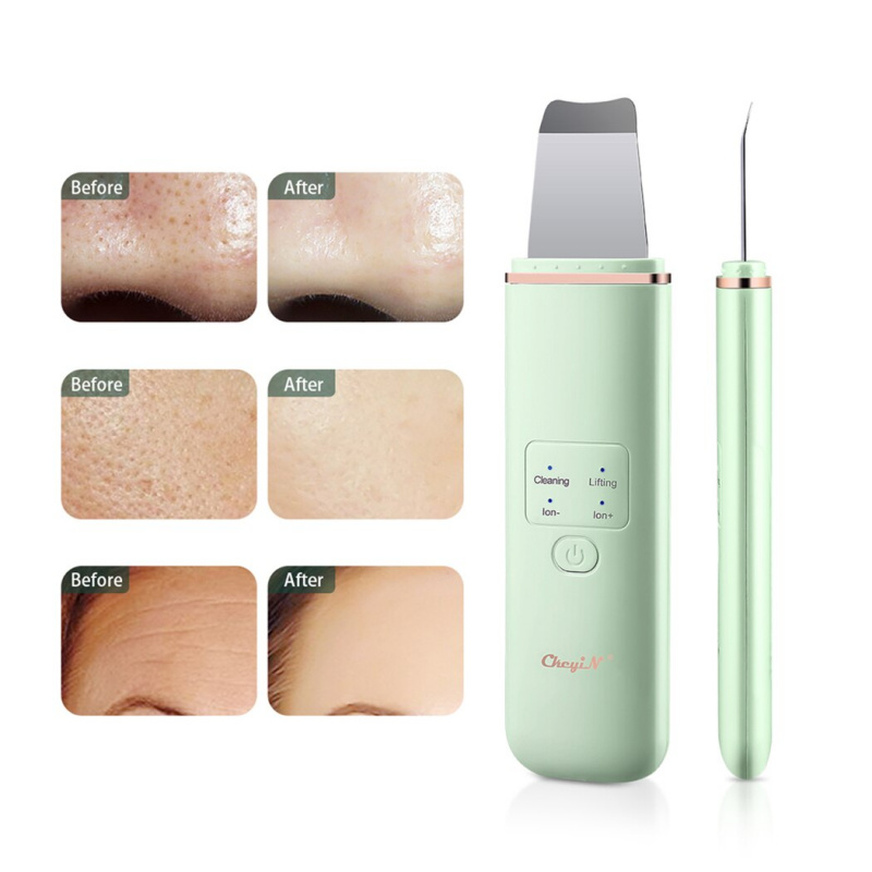 CkeyiN Ultrasonic Face Cleansing Tool Ultrasound Peeling Blackhead ...