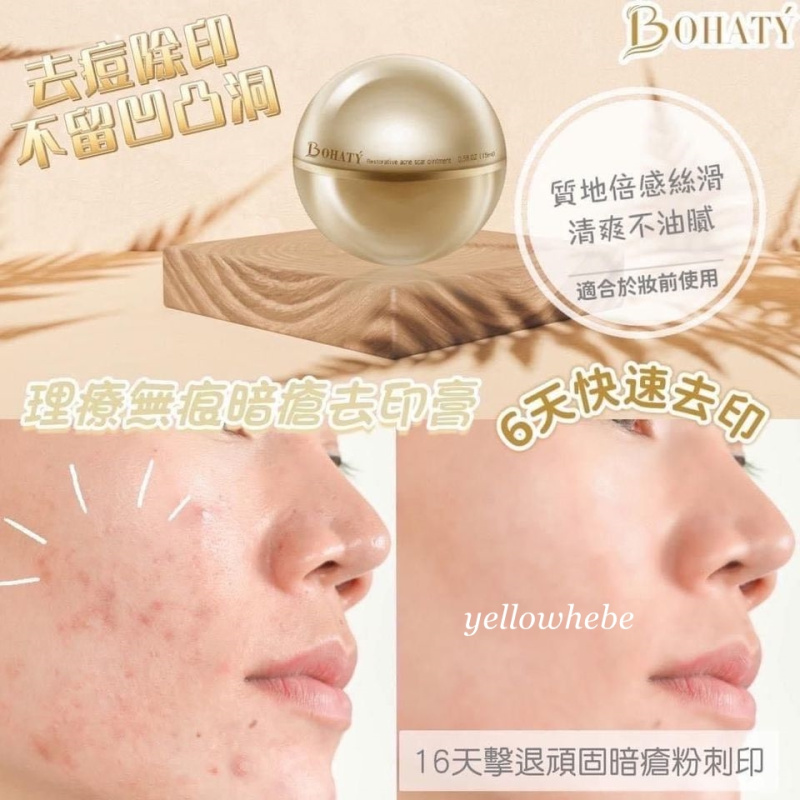 Bohaty 神奇小金球***理療無痕暗瘡去印膏 15ml - YELLOWHEBE SHOP
