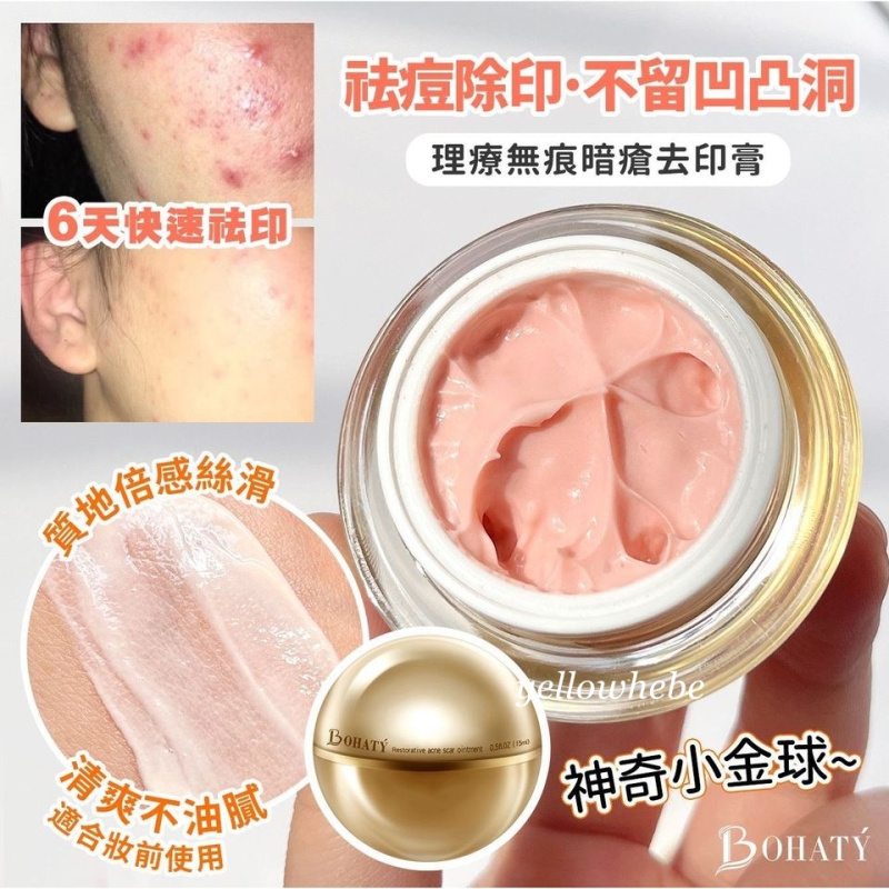 Bohaty 神奇小金球***理療無痕暗瘡去印膏 15ml - YELLOWHEBE SHOP